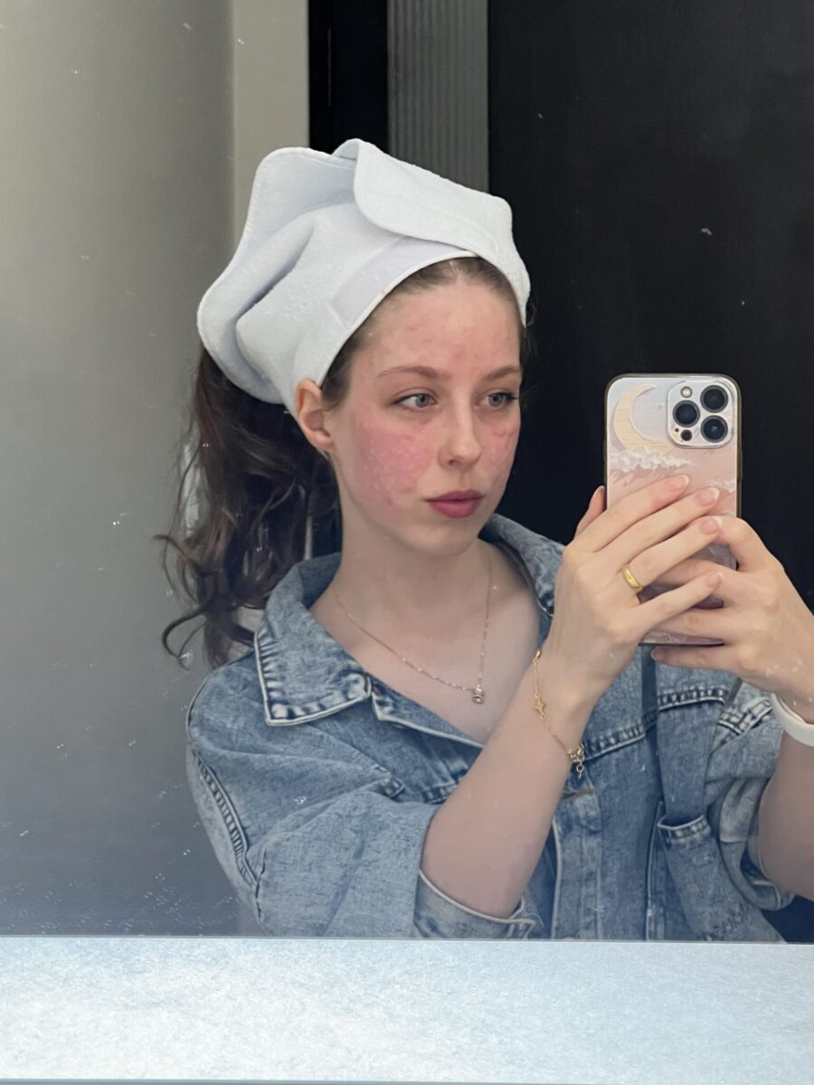 리쥬란 HB 2cc + 릴리드 스킨 부스터 “땡큐PS” – INFLO